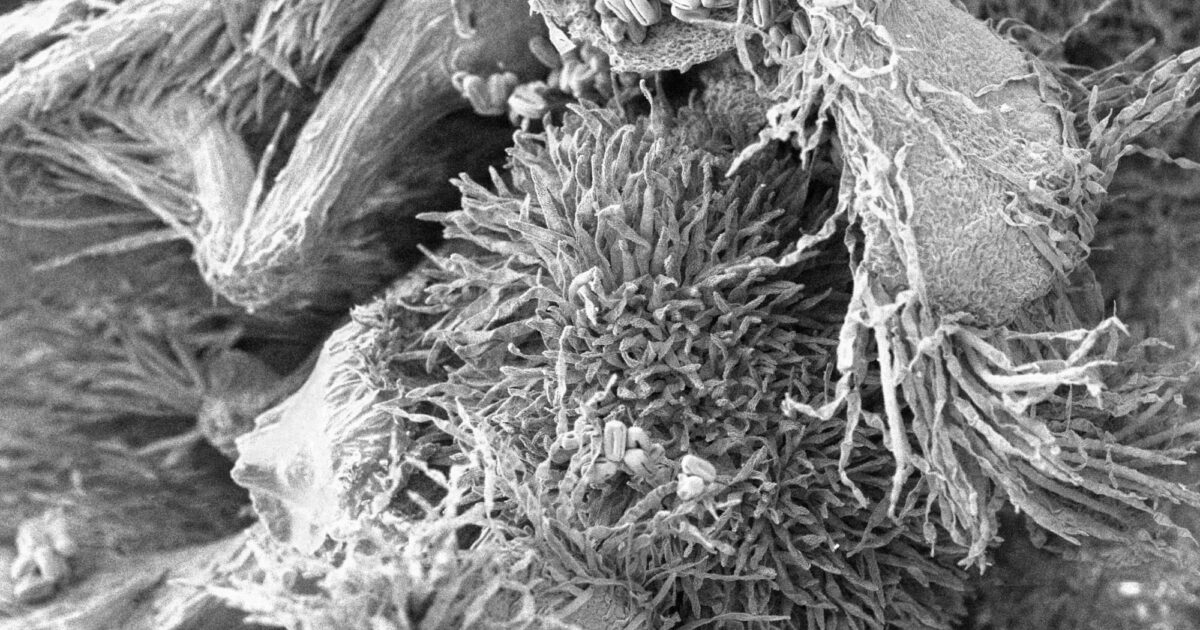 Microscopic Exchange | MIT Museum